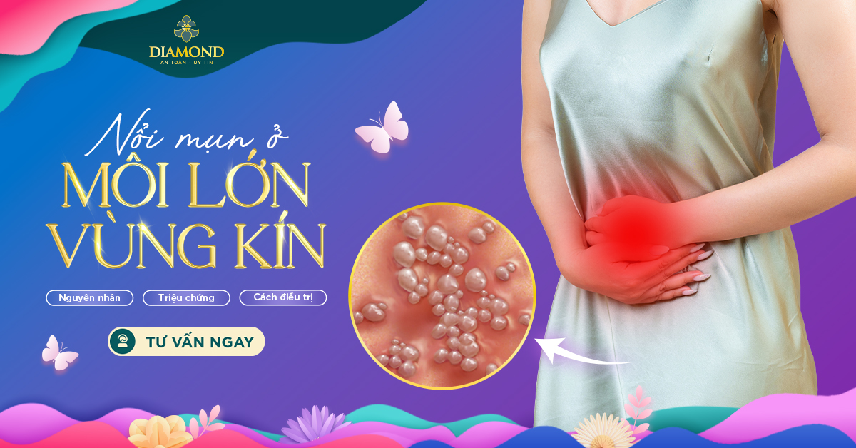 Nổi mụn ở môi lớn vùng kín: nguyên nhân, triệu chứng và cách trị